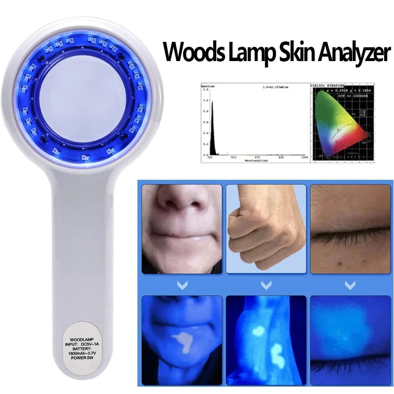 NEW Woods Lamp Skin Analyzer Portable Facial Salon Beauty Analyzer UV ...